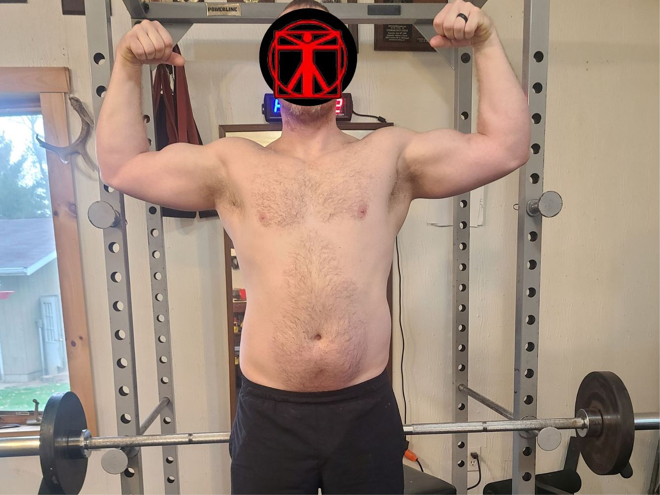 About Elite Hormones - Learn More - Elite Hormones